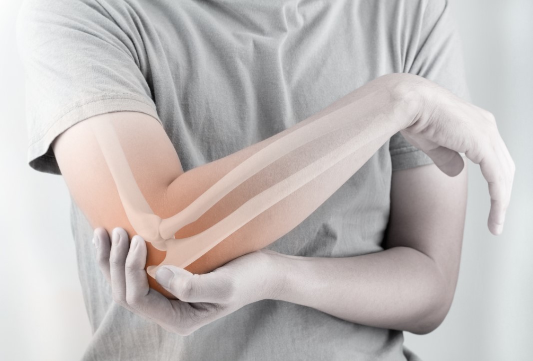 How to Recover From Tendinitis and Tendon Injuries - Richannel